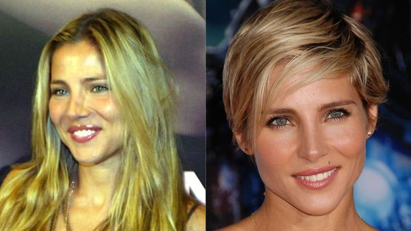 El antes y el después de los adictos al bisturí