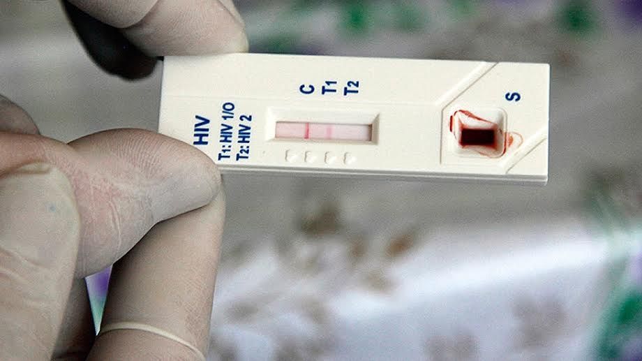 Las farmacias asturianas podrán realizar la prueba rápida del VIH-SIDA